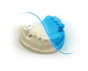 Lab-based scanning voor ATLANTIS abutments - Tandtechnisch Magazine